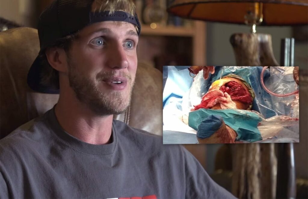 Video: Brett Cue ALL IN - My three year journey to X GAMES 2015 ...